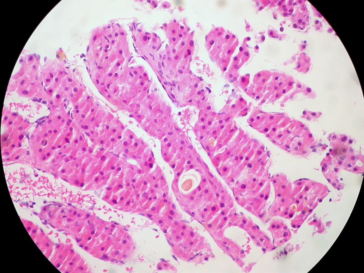 U.S. FDA gives rare designation to THC cancer drug in clinical trials ...