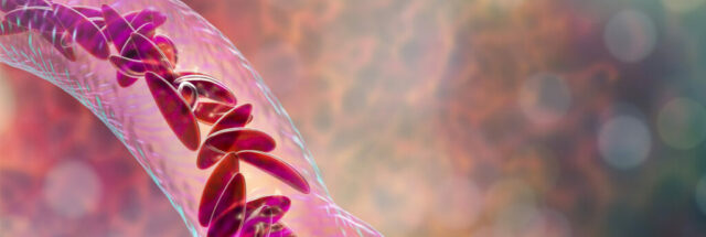 Lobe Sciences acquires rare blood disease treatment company ...