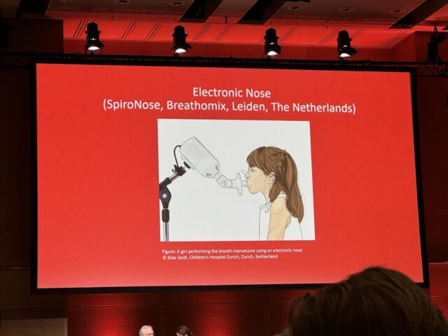 Lung cancer breath test demonstrates remarkable efficacy in Dutch study ...